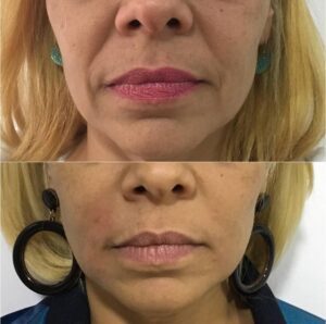 Curso Estética 15 em 1 - By Juliana Parra Funciona É bom Vale a Pena?